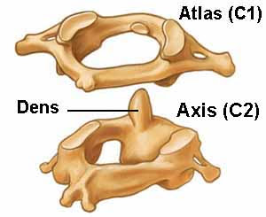osteologia: Atlas y el Axis